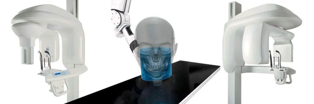 3D CBCT X-Ray Technology for Dental Implants in Mexico